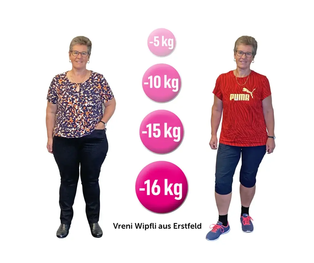 30 Kg Abnehmen Ohne Hautlappen